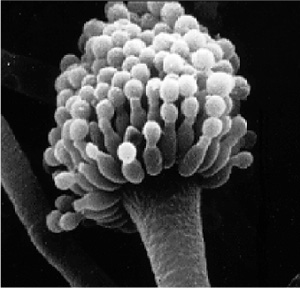 What are deuteromycetes—“imperfect fungi”—mentioned in many fungi ...